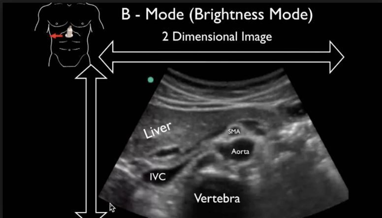 How It Works: Ultrasound Modes – AME