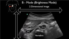 How It Works: Ultrasound Modes – AME