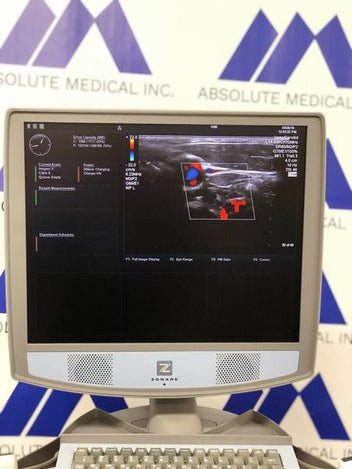 Zonare Z One Ultrasound System – AME